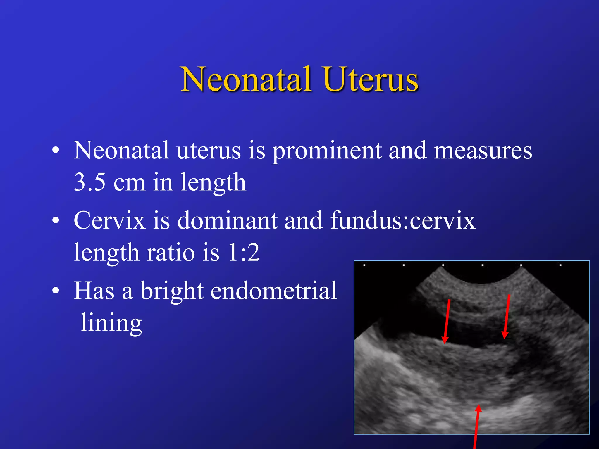 Ultrasound of uterus, part 1 | PPTX