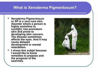 Gidowatch - Xeroderma Pigmentosum | PPT