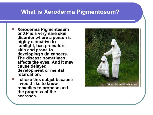 Gidowatch - Xeroderma Pigmentosum | PPT