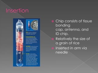 The Veri Chip | PPT
