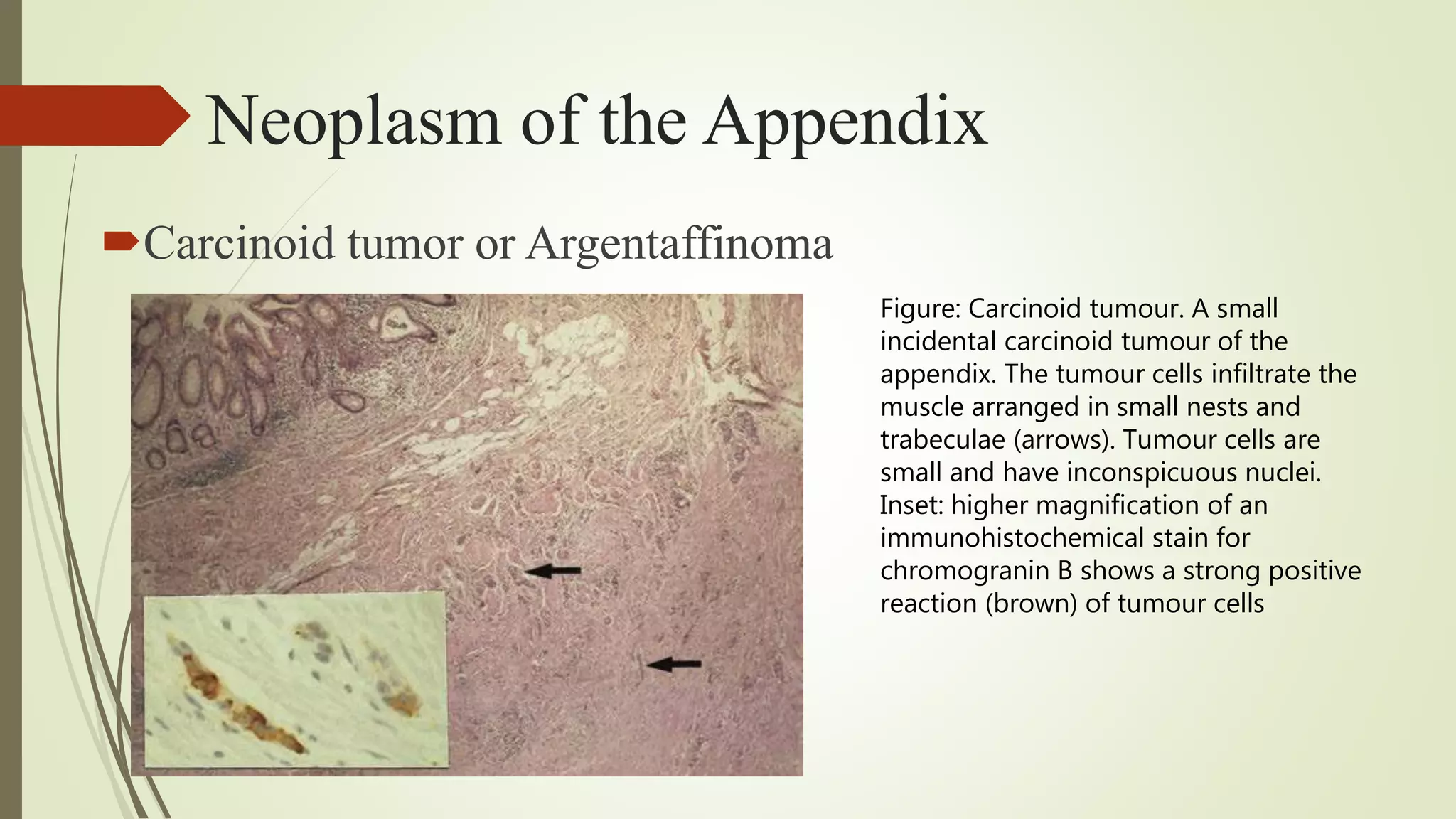 The Vermiform Appendix.pptx