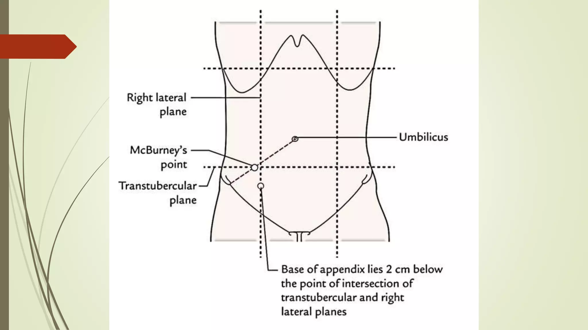 The Vermiform Appendix.pptx