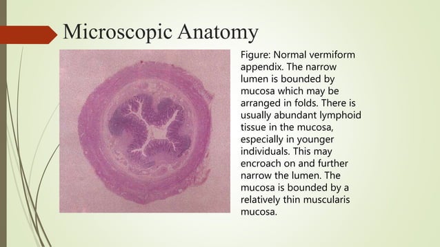 The Vermiform Appendix.pptx | Digestive Disorders | Diseases and Conditions