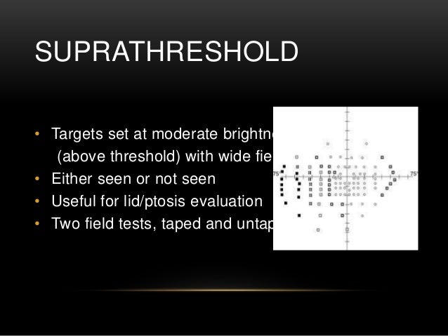 The Visual Field for Technicians