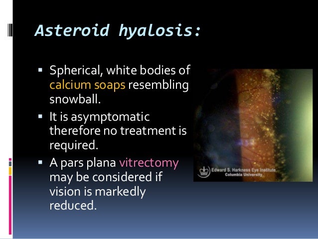 The vitreous for undergraduate
