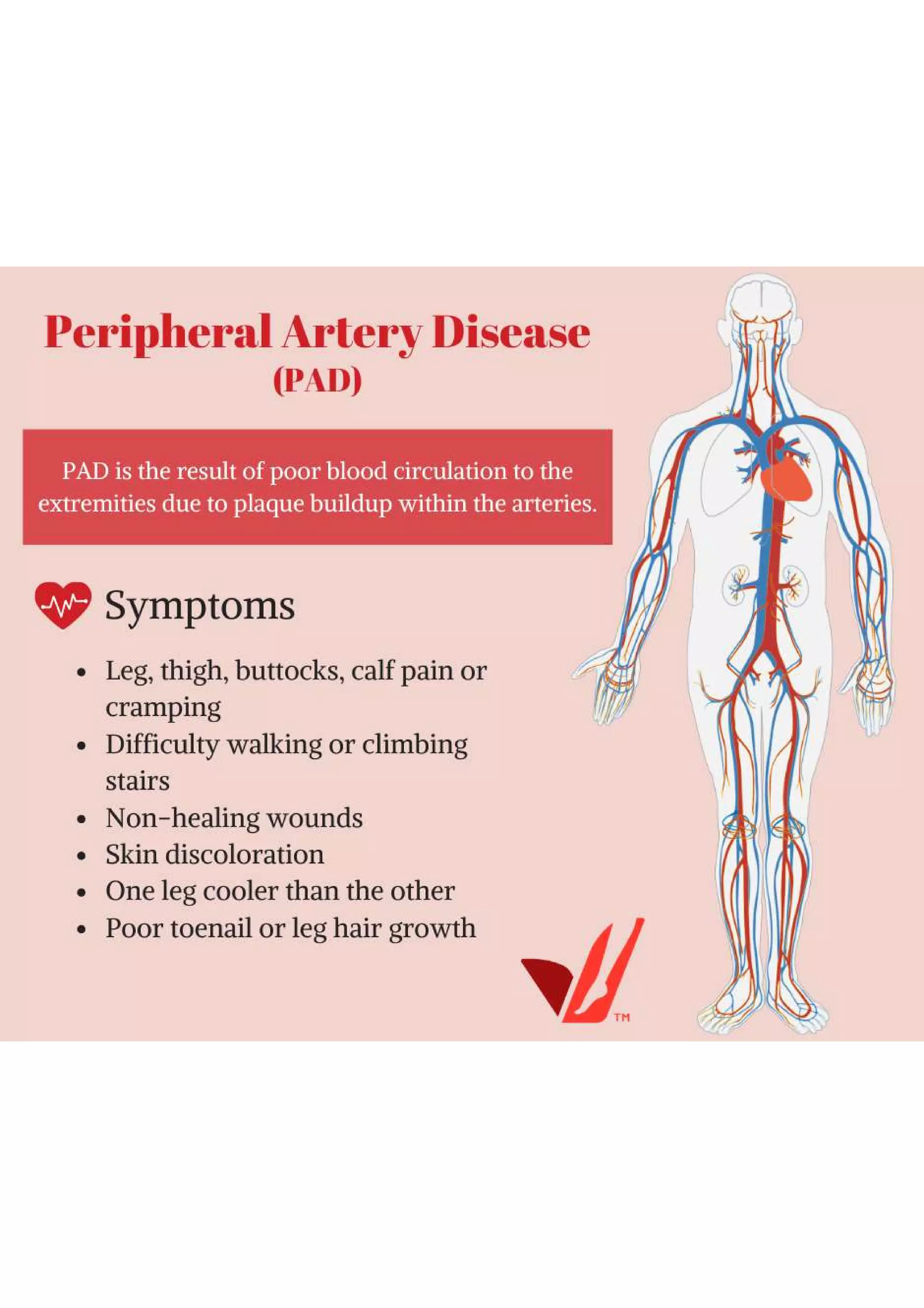 The Warning Signs of PAD - USA Vascular Centers | PDF