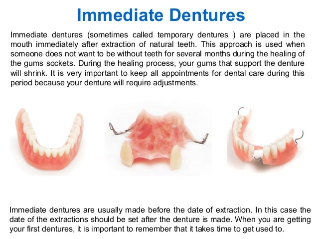 Immediate Dentures Steps
