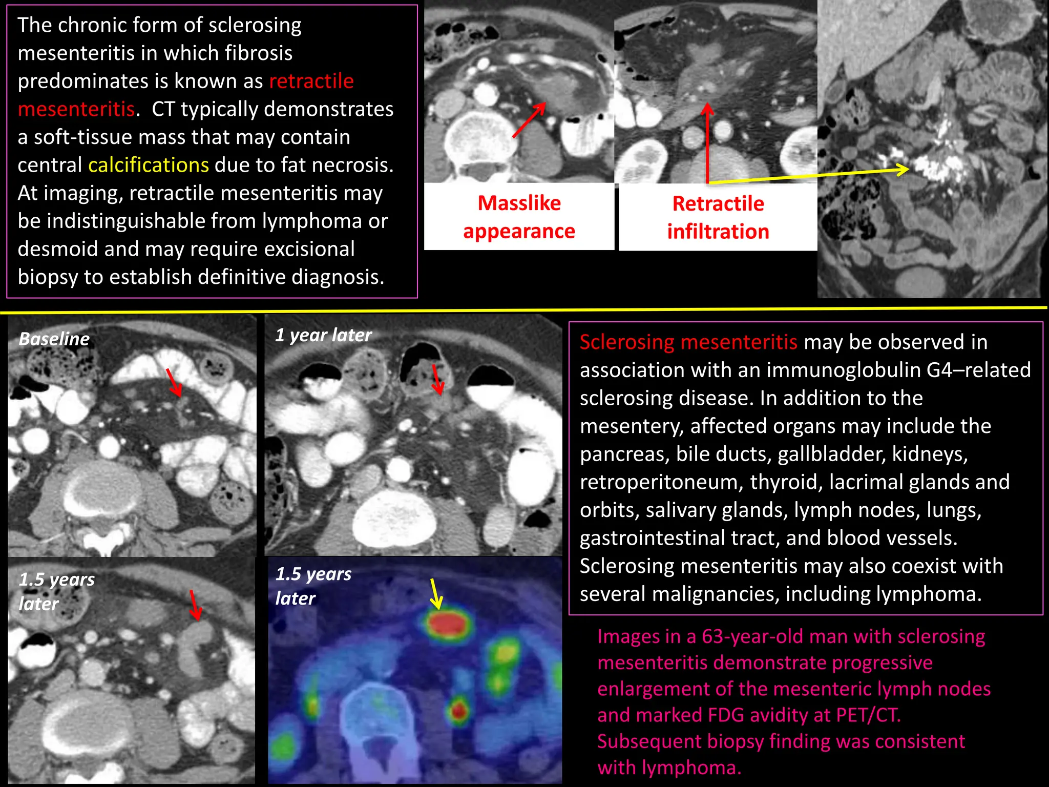 The Wheel of the Mesentery.pptx