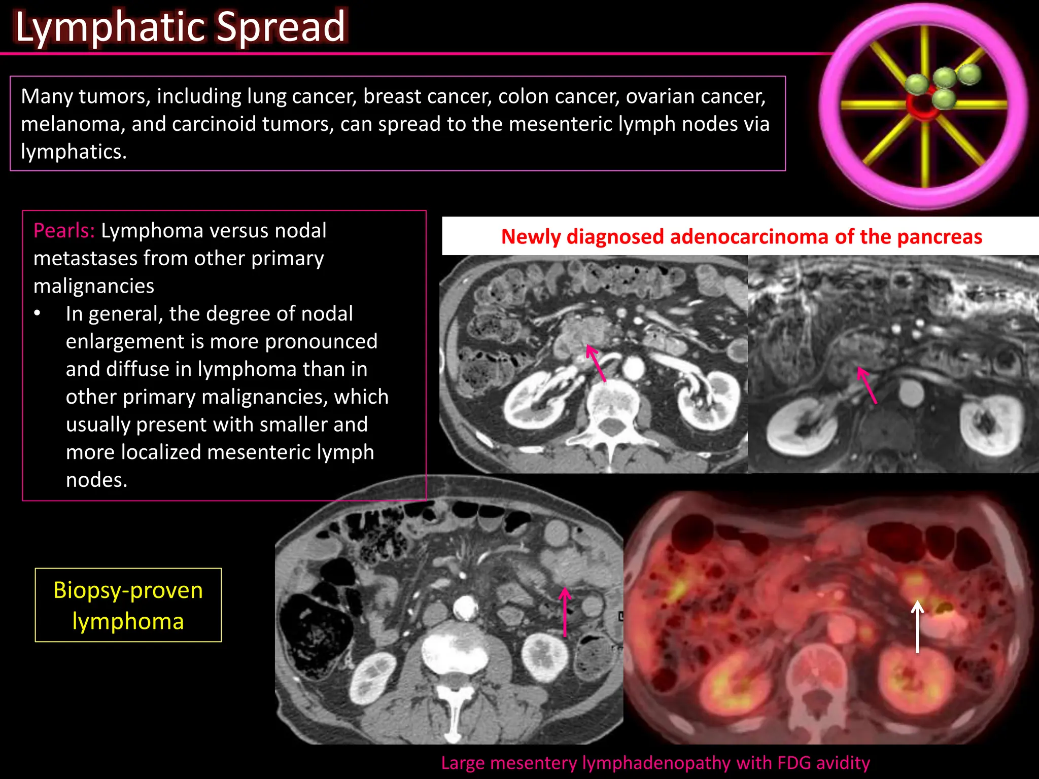 The Wheel of the Mesentery.pptx