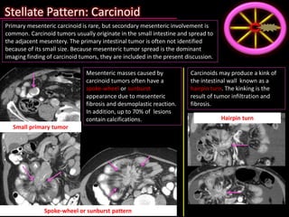 The Wheel of the Mesentery.pptx