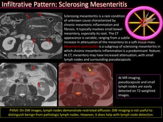 The Wheel of the Mesentery.pptx