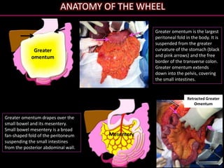 The Wheel of the Mesentery.pptx