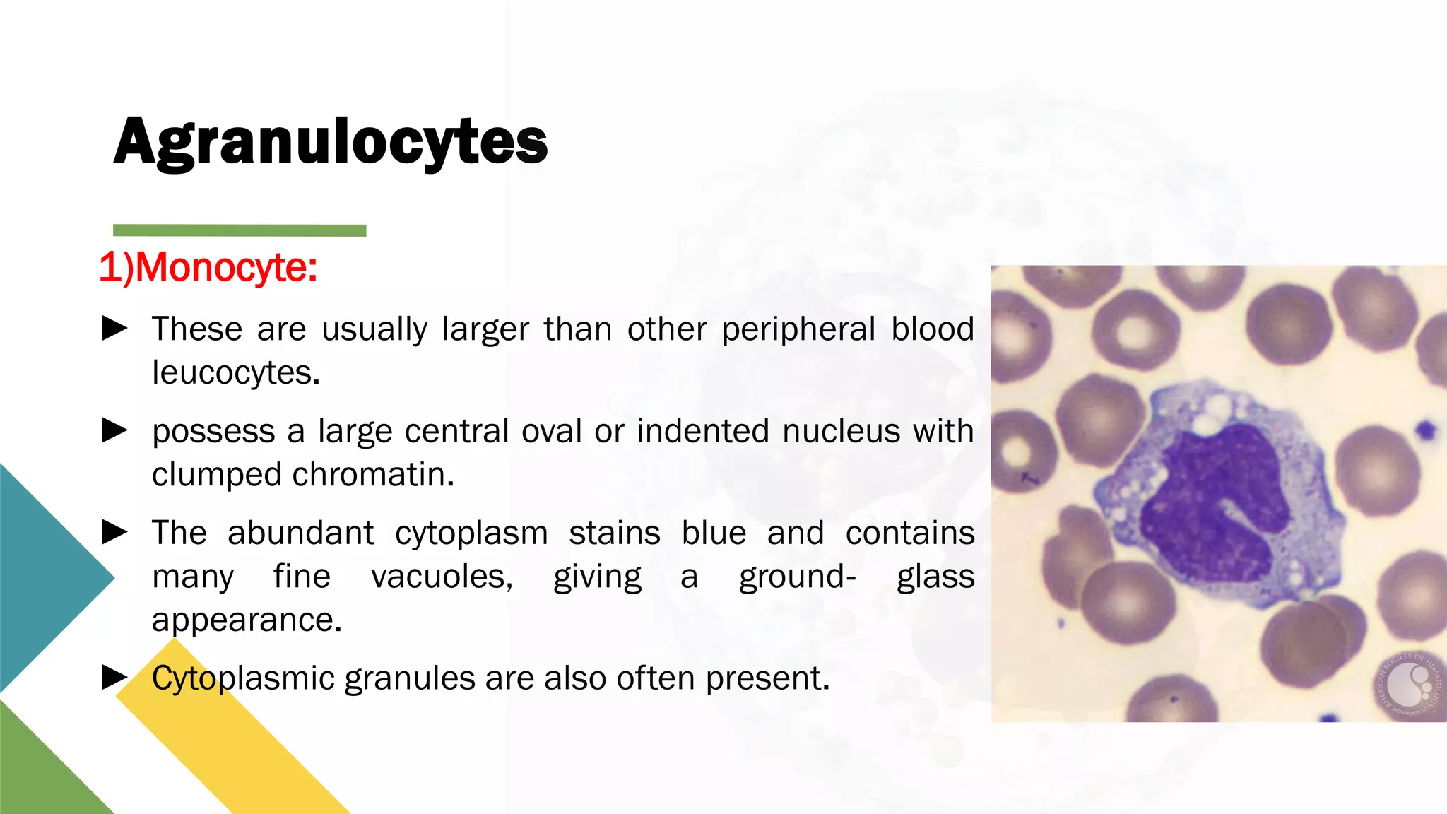 The white cells granulocytes and their benign disorders | PDF
