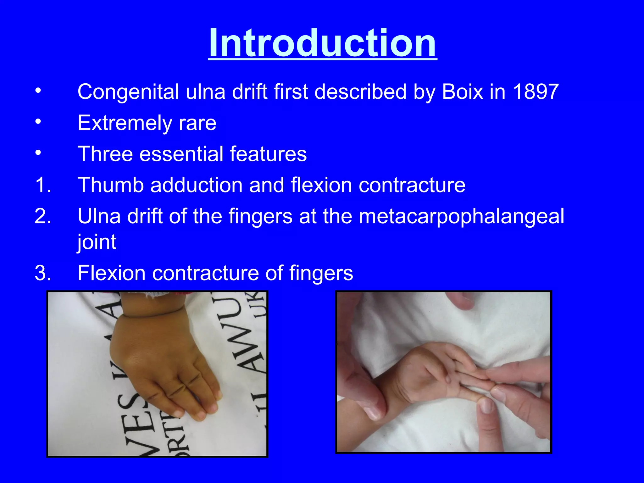 The windblown hand | PPT
