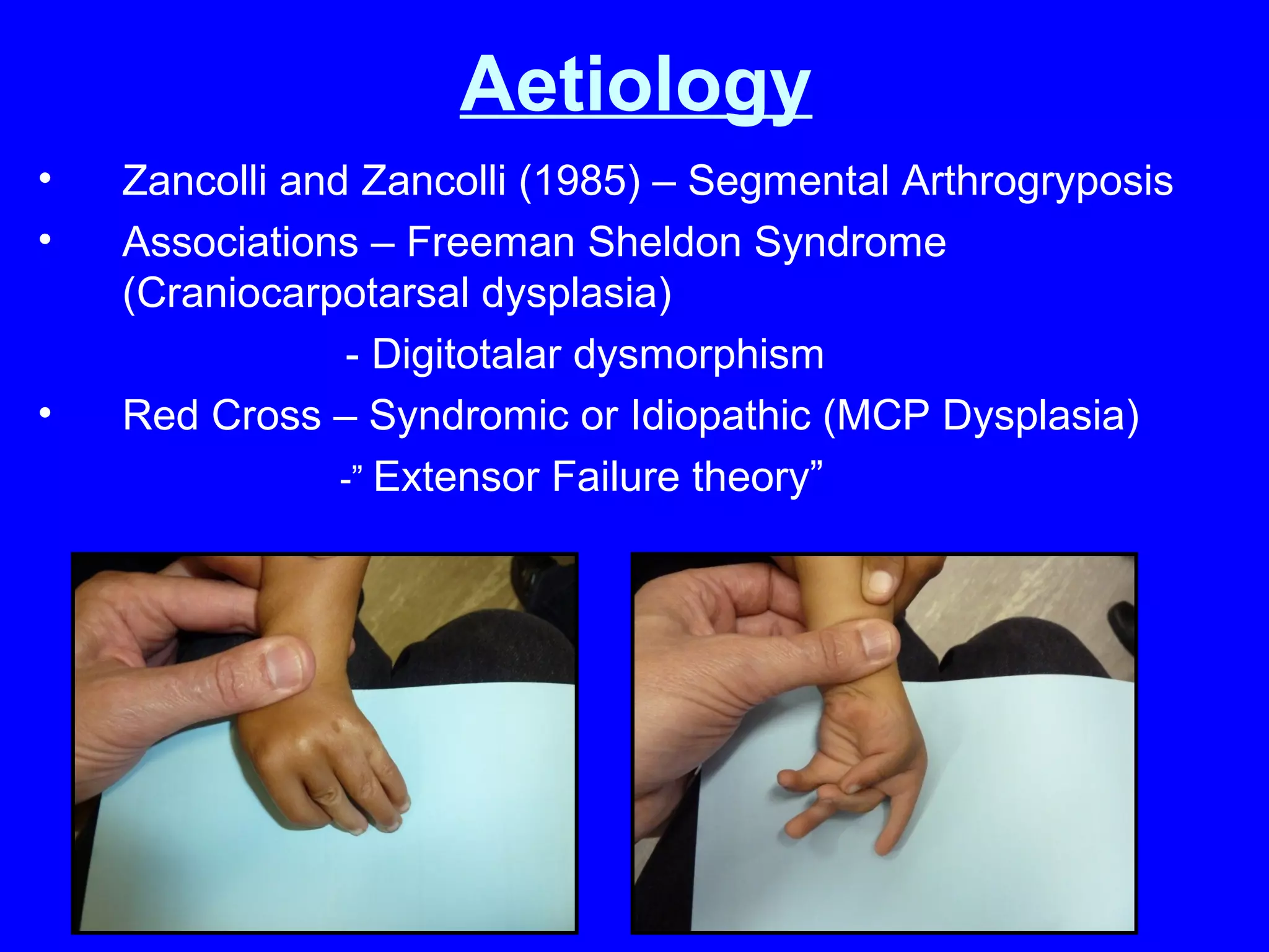 The windblown hand | PPT