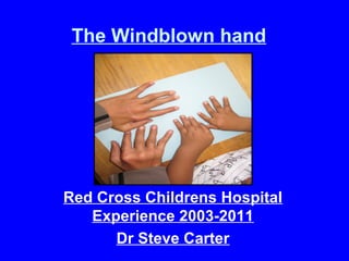 The windblown hand | PPT
