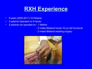 The windblown hand | PPT