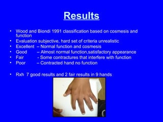 The windblown hand | PPT