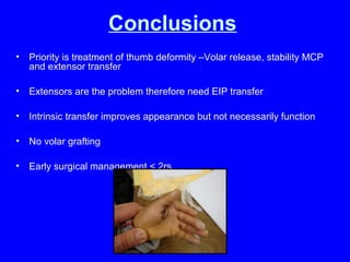 The windblown hand | PPT