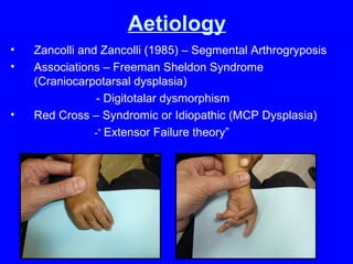 The windblown hand | PPT