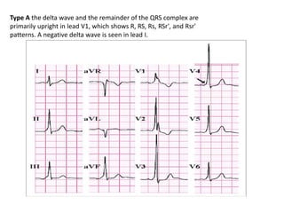 THE WOLFF–PARKINSON–WHITE.pptx