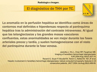 El diagnóstico de Telangiectasia Hemorrágica Hereditaria (THH) | PPTX