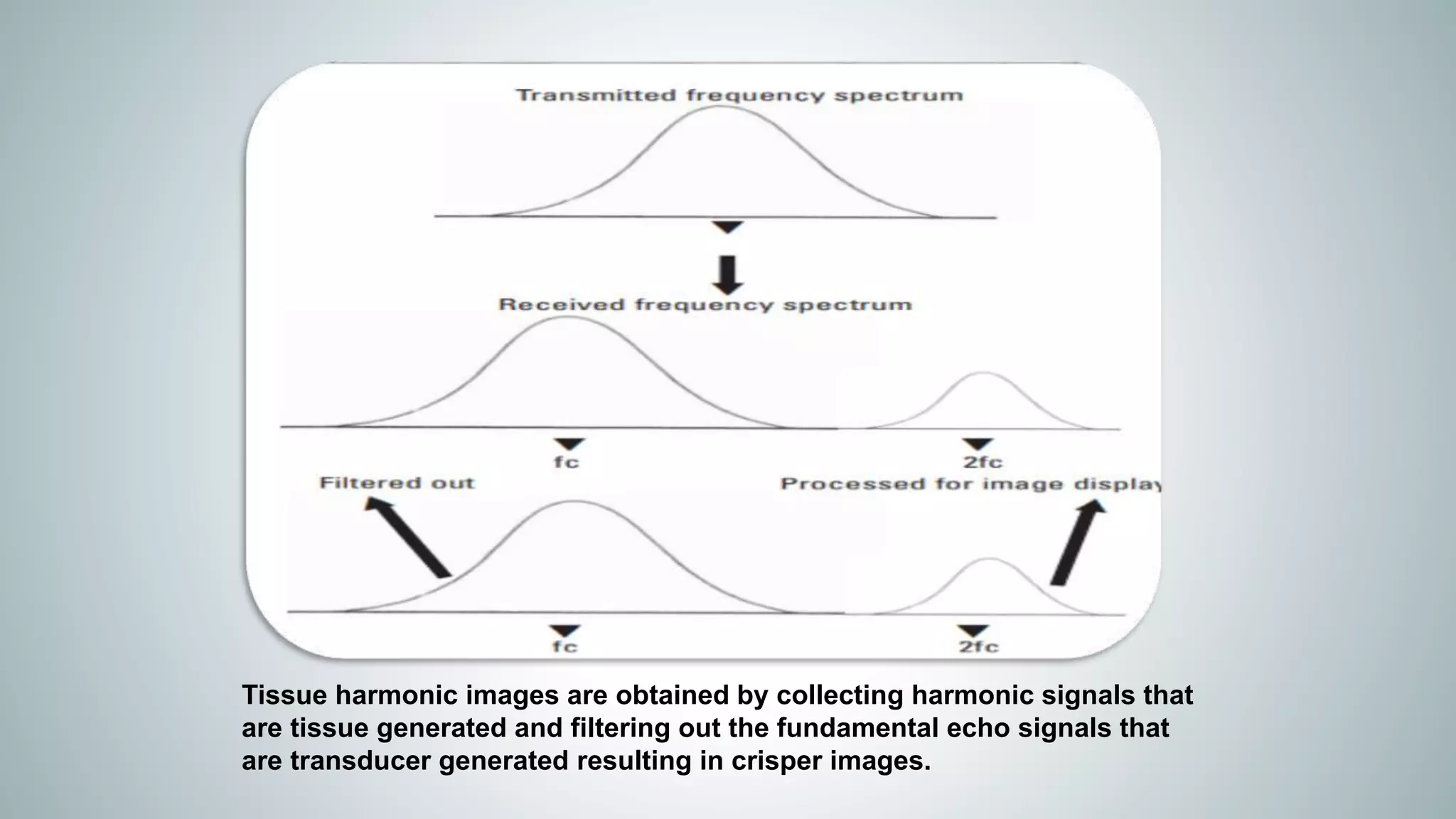 Tissue harmonic imaging | PPTX
