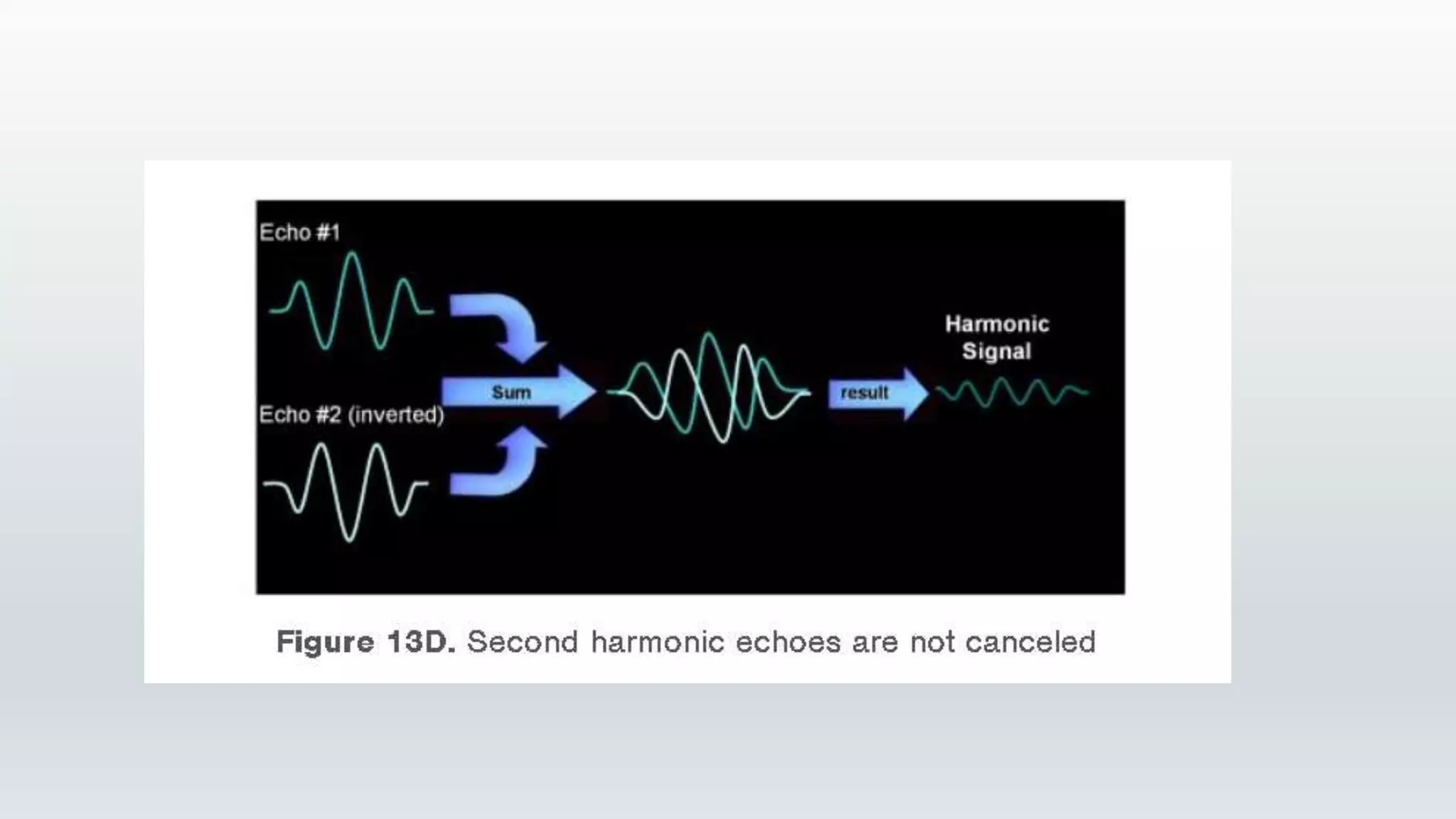 Tissue harmonic imaging | PPTX
