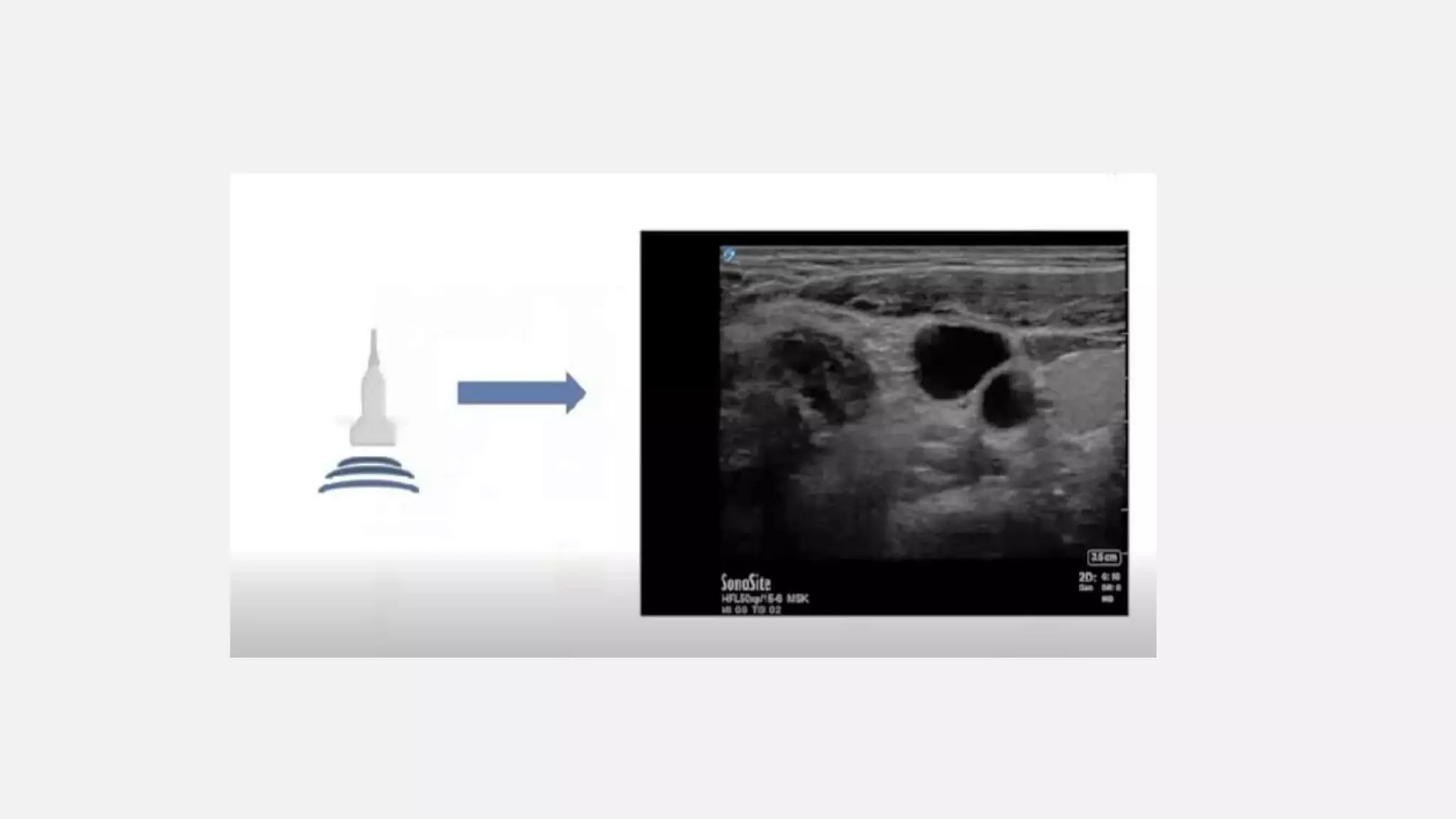 Tissue harmonic imaging | PPTX