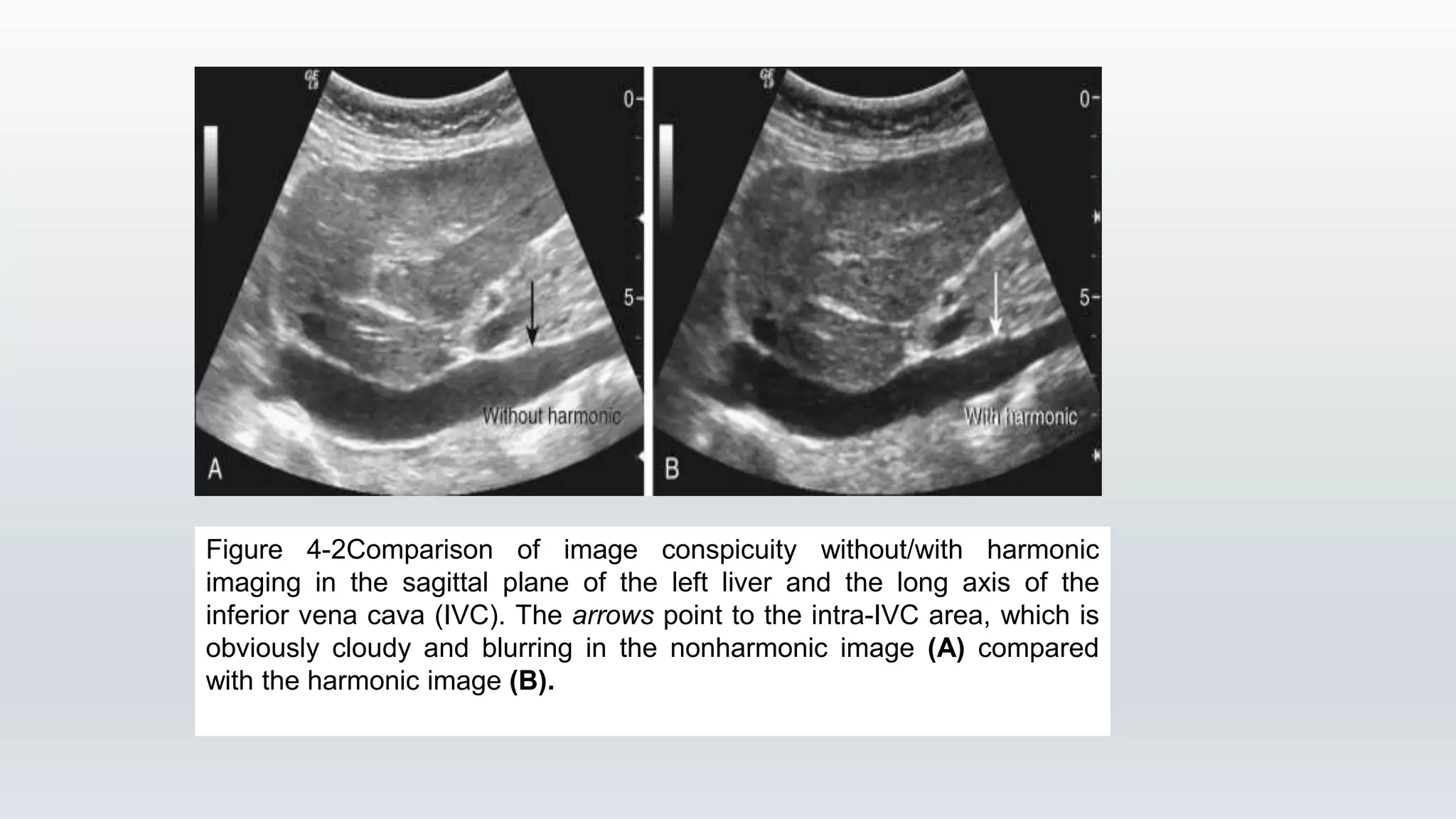 Tissue harmonic imaging | PPTX