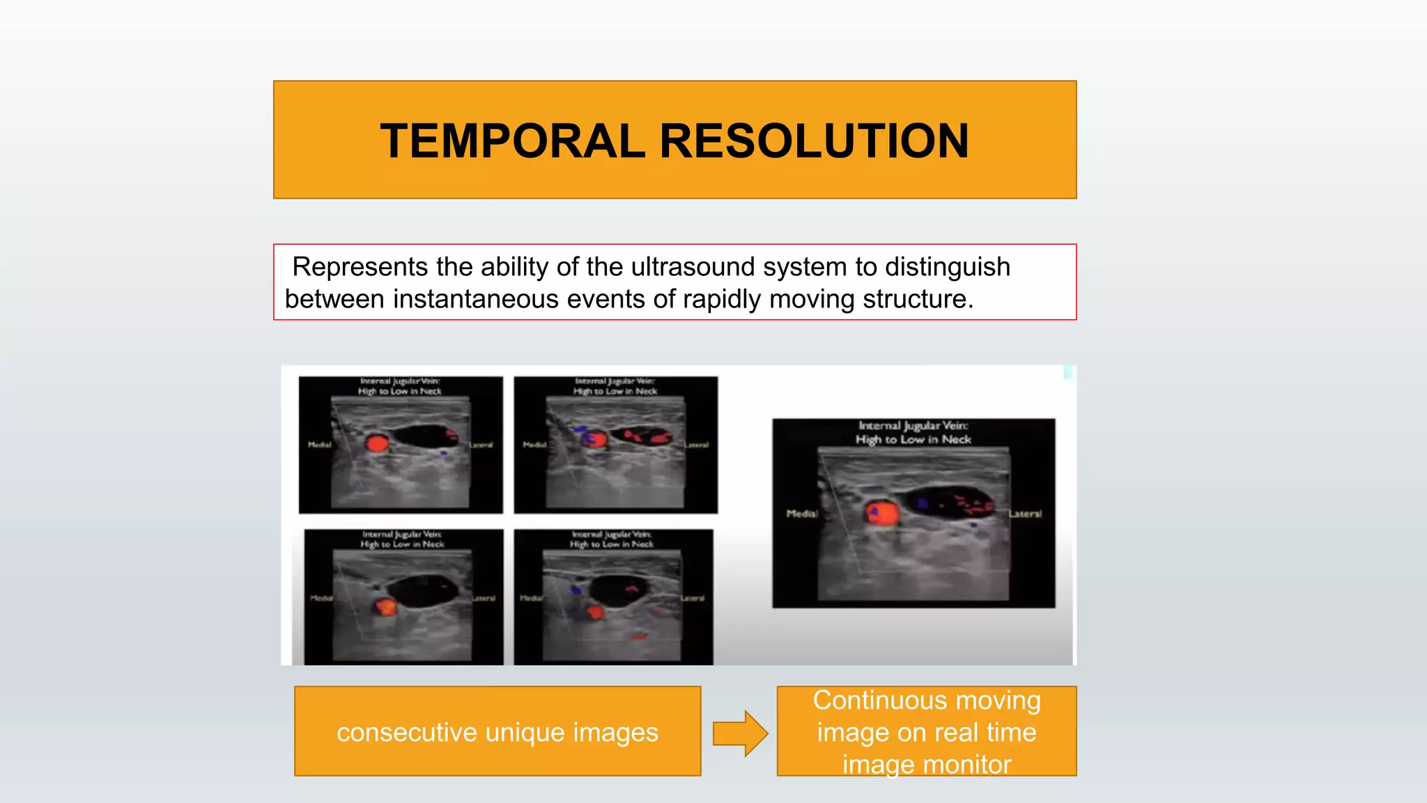 Tissue harmonic imaging | PPTX