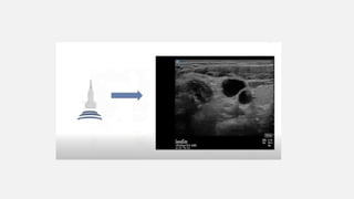 Tissue harmonic imaging | PPTX
