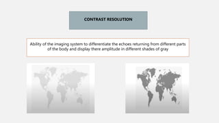 Tissue harmonic imaging | PPTX