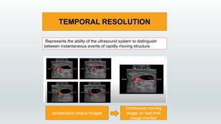 Tissue harmonic imaging | PPTX