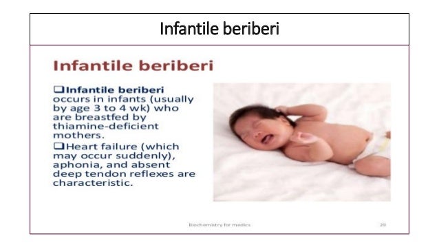 Thiamine and beriberi