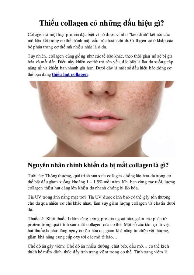 Thiếu collagen có những dấu hiệu gì? | PDF