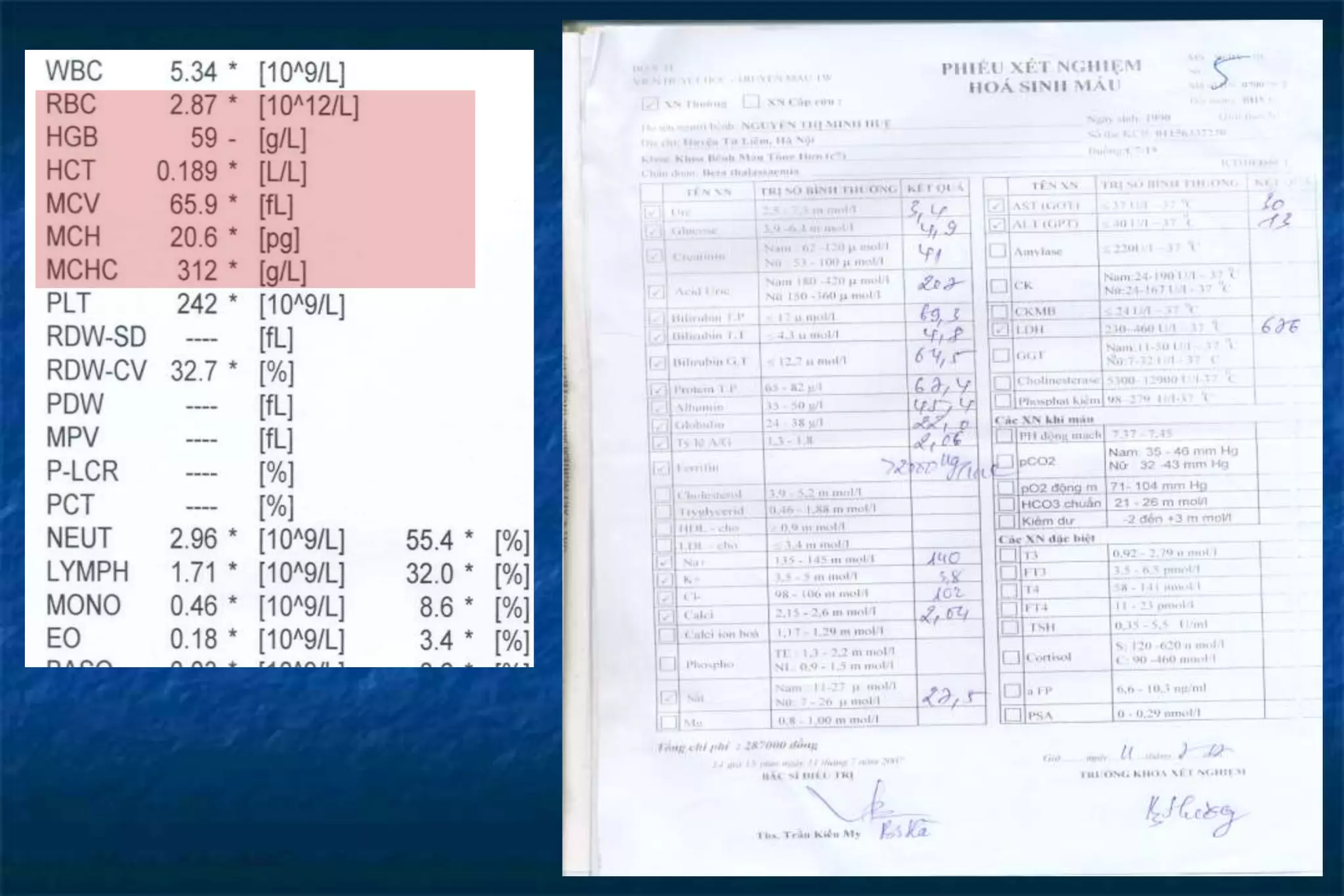 thieu-mau.ppt | Free Download