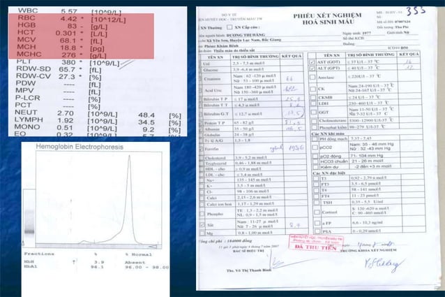 thieu-mau.ppt | Free Download