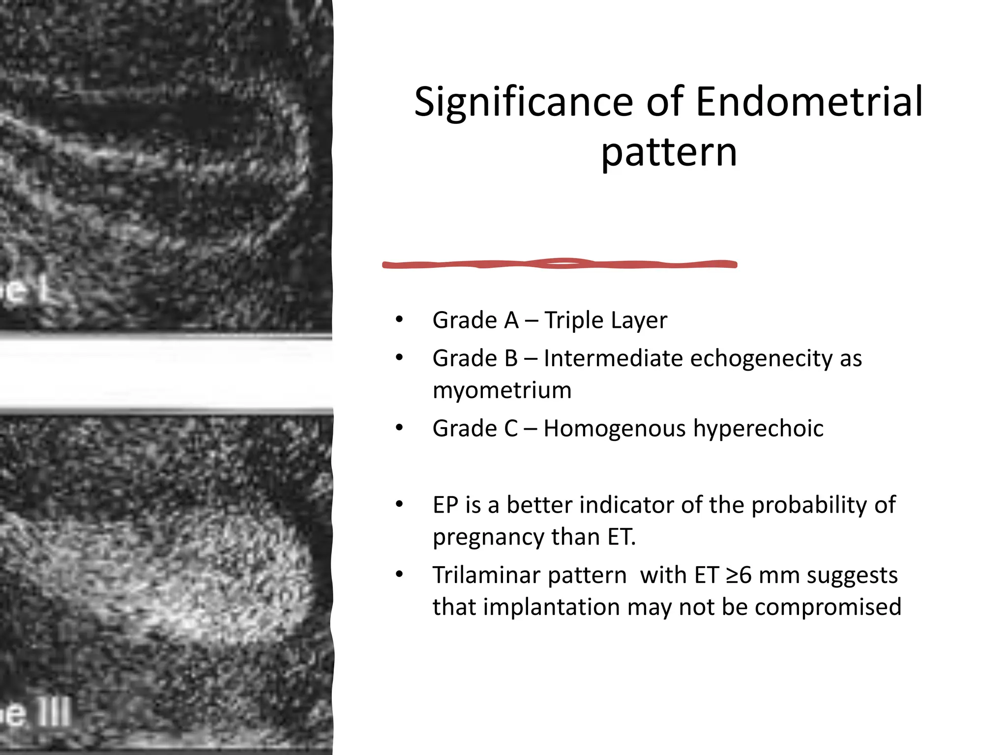 The Thin endometrium- Where are we today? | PPTX