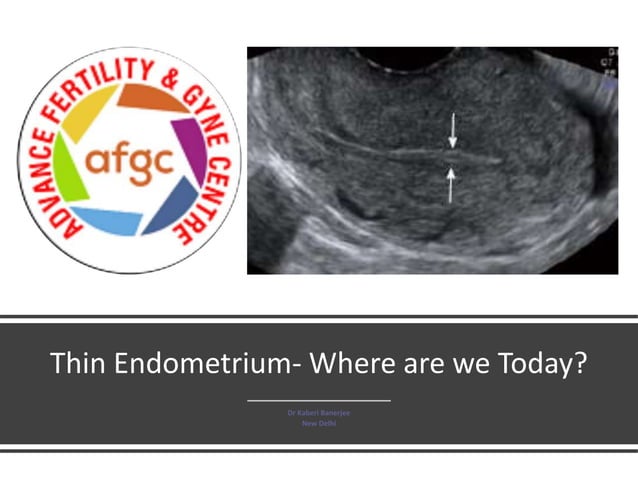 The Thin endometrium- Where are we today? | PPTX