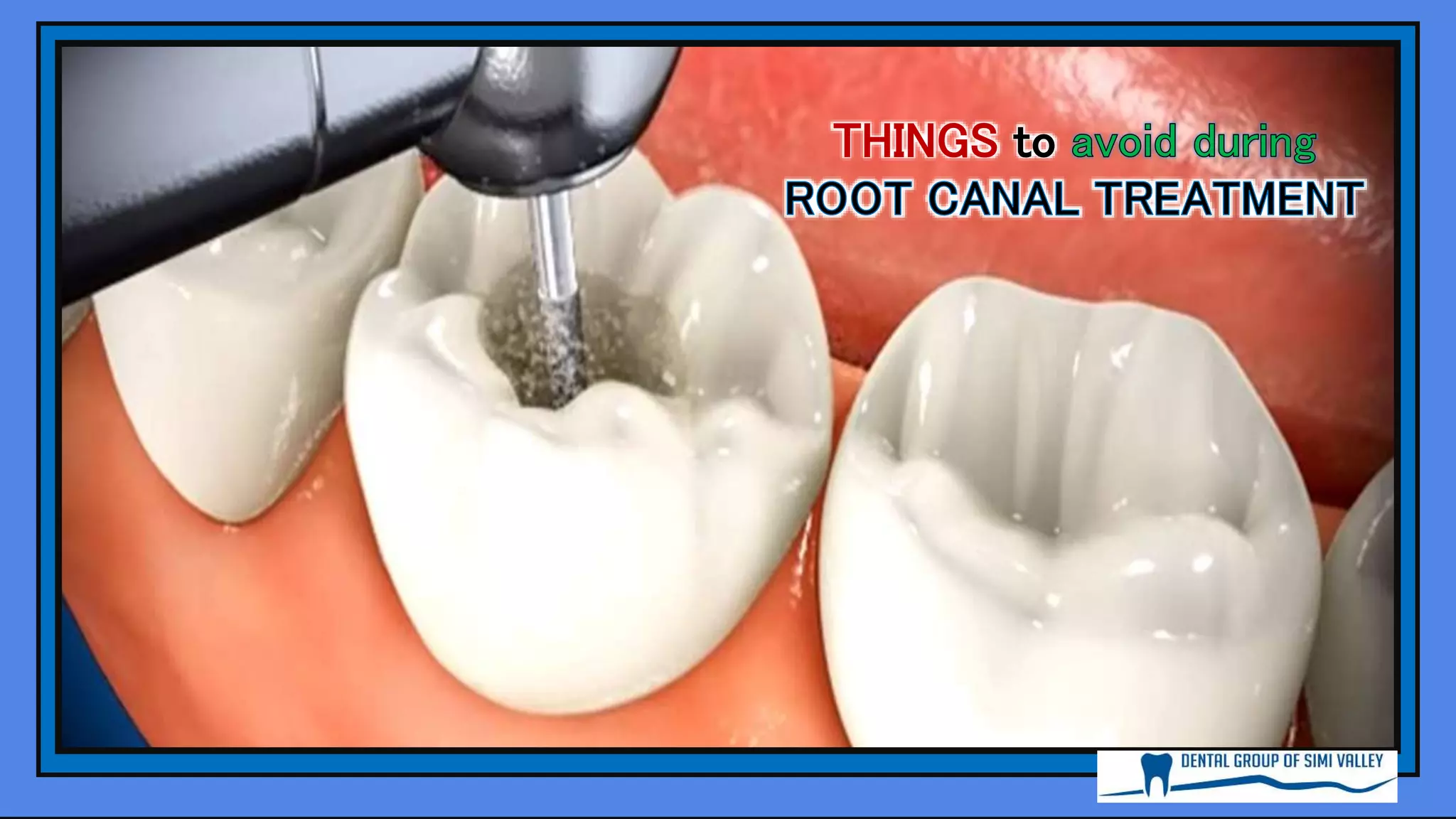 Things to Avoid During a Root Canal Treatment | PPTX