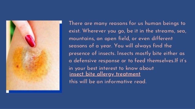 Things to know about insect bites: an overview | PDF