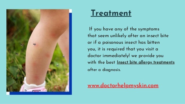 Things to know about insect bites: an overview | PDF