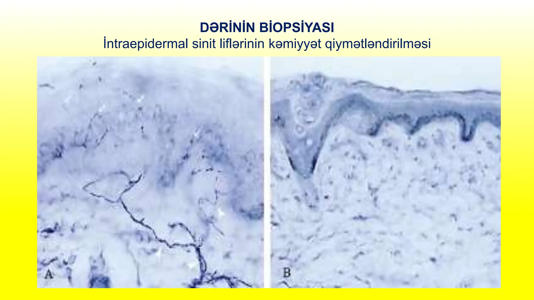 Thiogamma diabetes mellitus alfa tictic acid | PPT