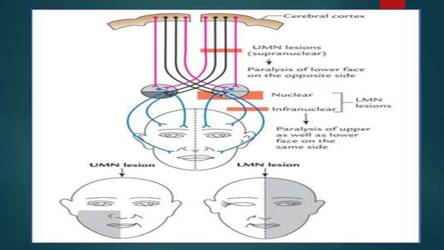 physiology of trigeminal nerve, UMNL& LMNL facial paralysis, taste