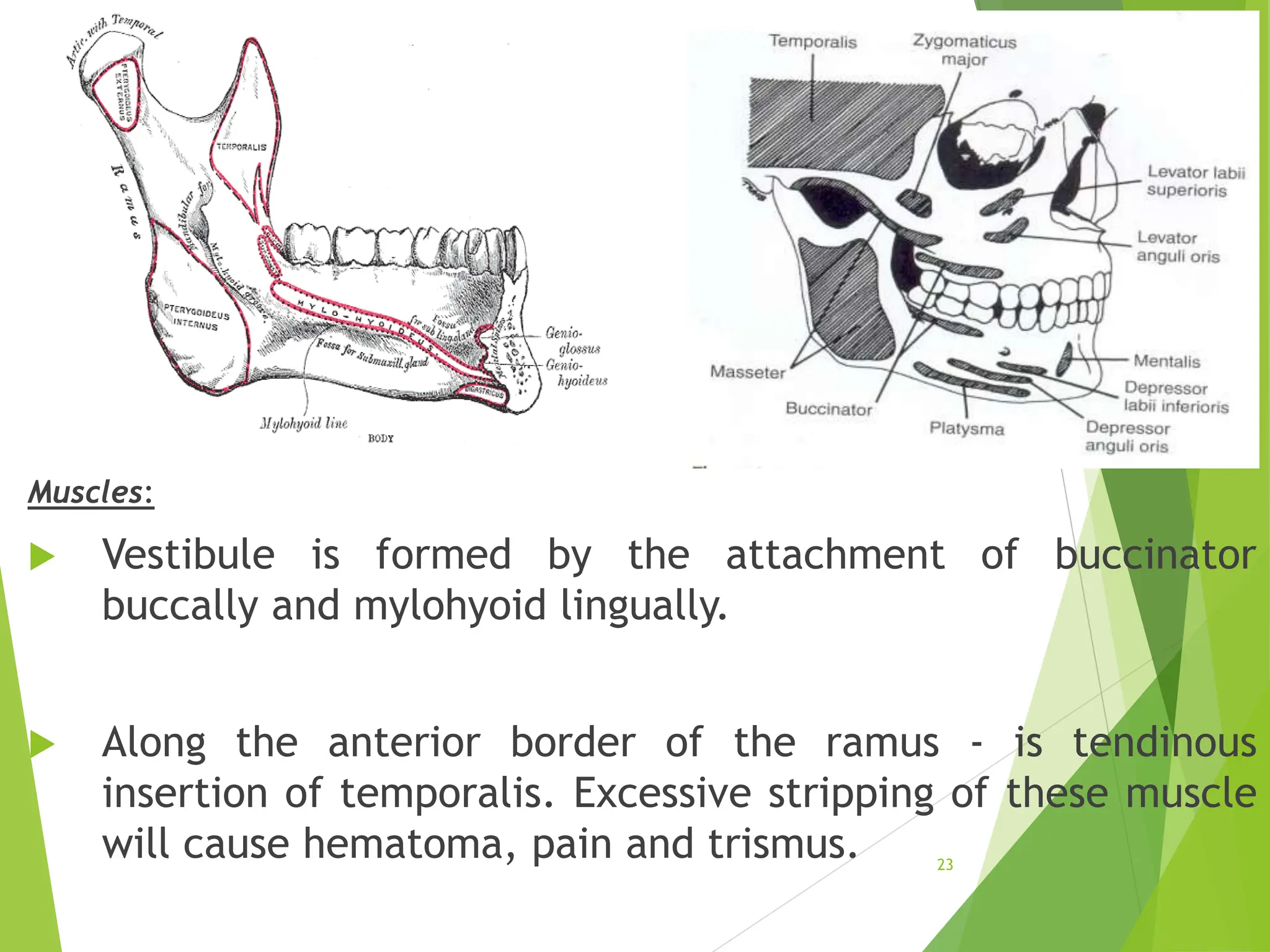 THIRD MOLAR IMPACTed tooth , development & Surgical complications.pptx
