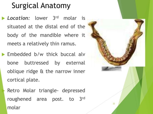 THIRD MOLAR IMPACTed tooth , development & Surgical complications.pptx