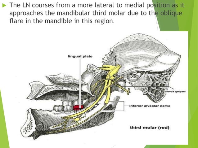THIRD MOLAR IMPACTed tooth , development & Surgical complications.pptx