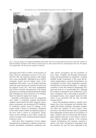 Third molar surgery | PDF