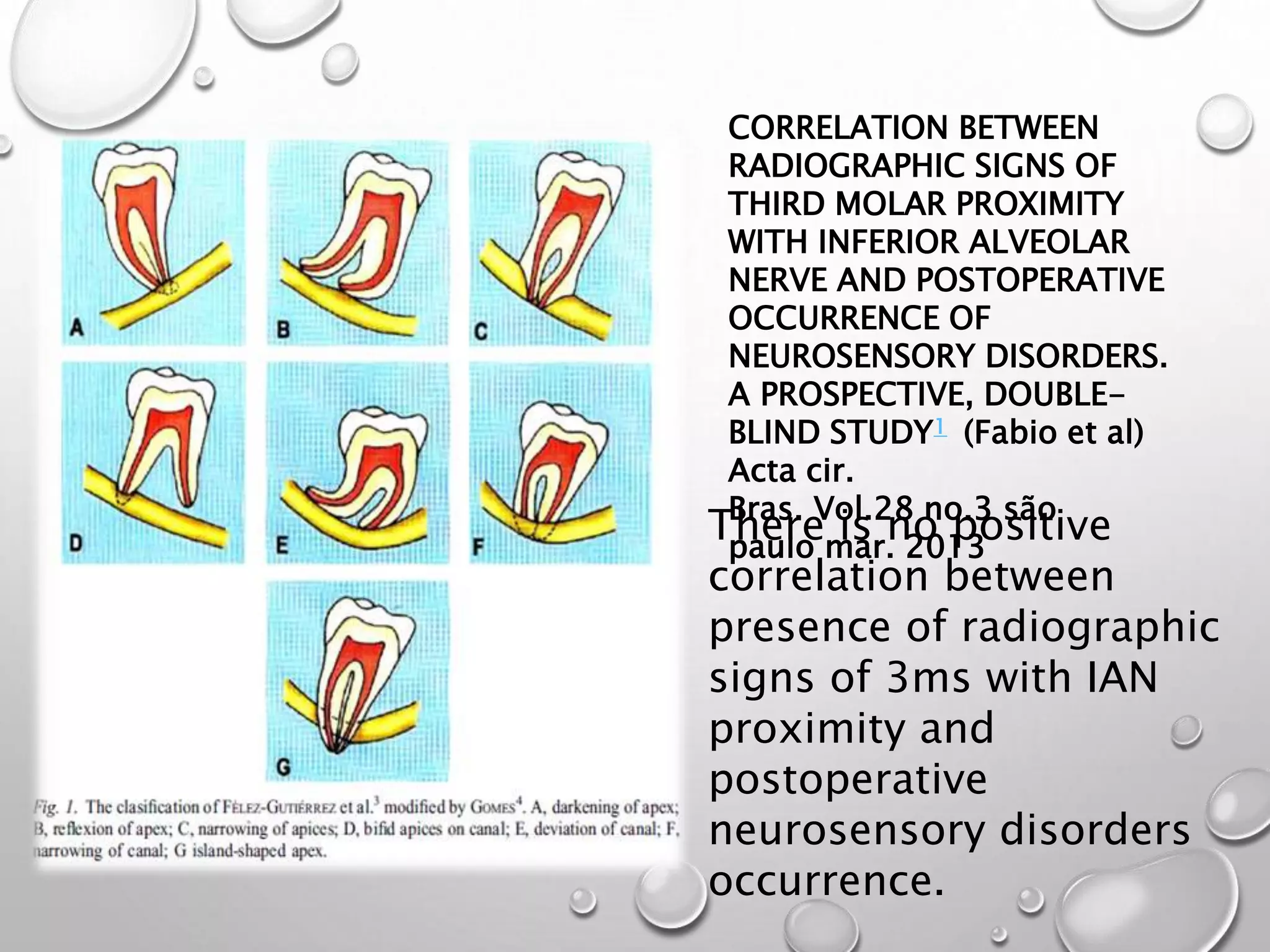 Third molar surgery | PPTX